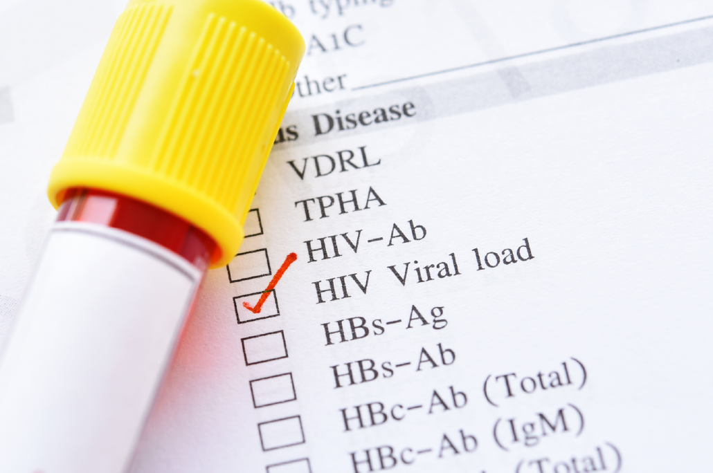 Tener un nivel de VIH detectable persistentemente bajo aumenta el ...