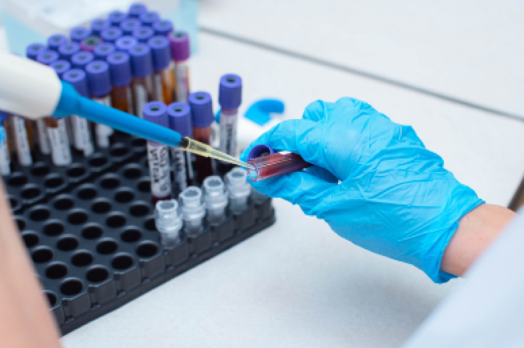 Transmisión - gTt-VIH